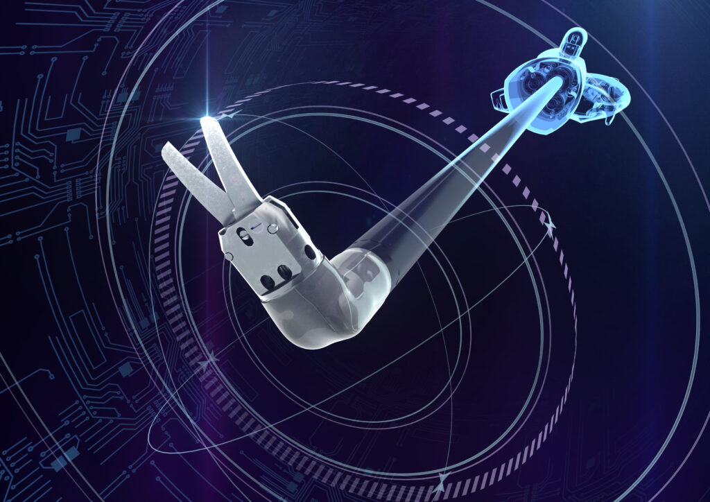 Robotic Laparoscopy | Medapp Healthcare Technology